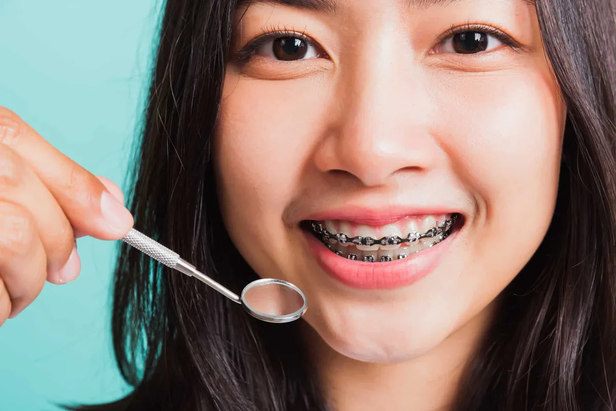 How to Get Free Braces with Medicaid (Qualify for Coverage) | NewMouth