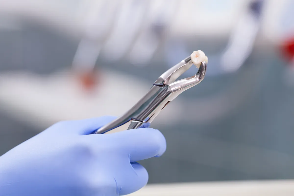 Tooth Cupping: Causes, Prevention, and Treatment | NewMouth