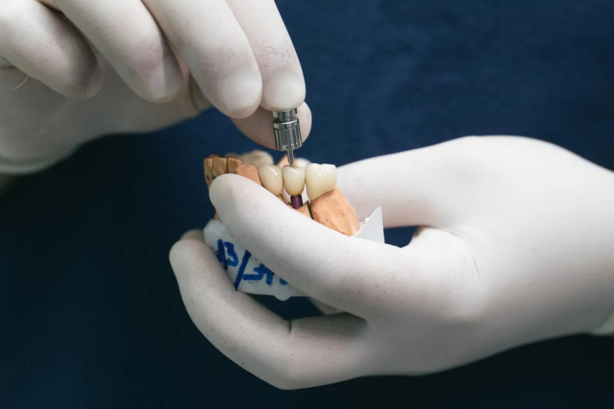 Single Tooth Denture - Procedure, Pros, Cons & Cost | NewMouth