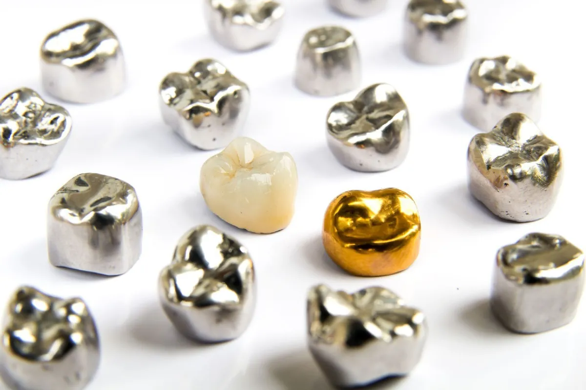 Gold Tooth Crowns - Procedure, Pros, Cons, & Costs | NewMouth