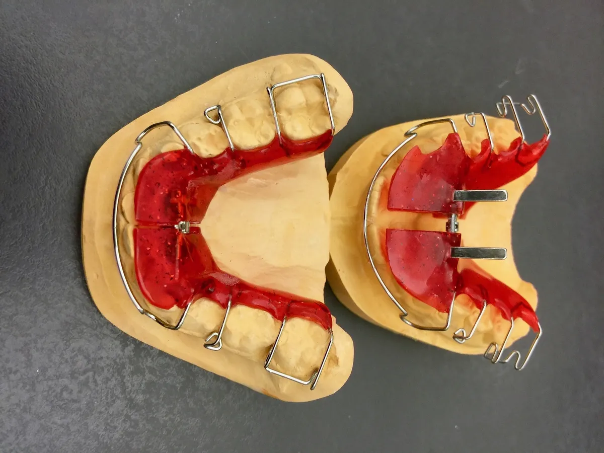 What is a Hawley Retainer? (Pros, Cons & Costs) | NewMouth