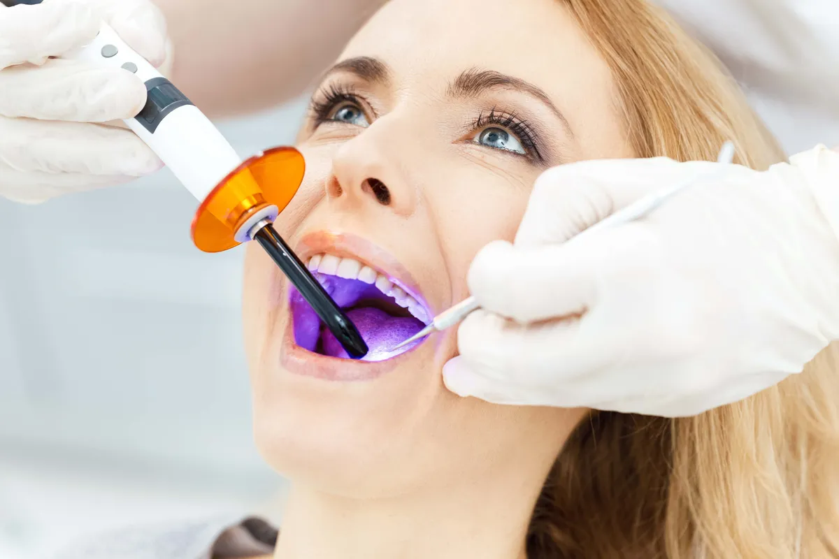 Internal Tooth Bleaching: How It Works and Cost | NewMouth