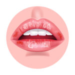 Cheilitis Lips: Symptoms, Causes, and Effective Treatments